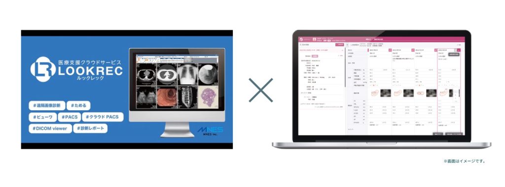 産婦人科向け電子カルテ『CLIPLA Luna』と株式会社エムネスの『LOOKREC』が連携を開始 | 株式会社クリプラ